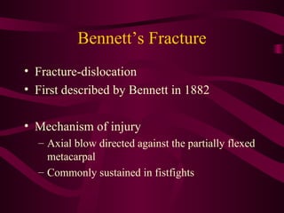 Thumb fractures | PPT