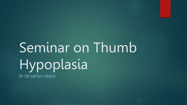 Thumb hypoplasia(4).pptx