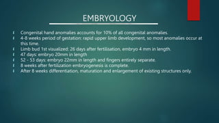 Thumb hypoplasia(4).pptx