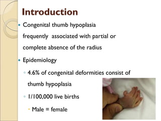 Thumb hypoplesia | PDF