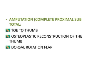 Thumb reconstruction | PPTX