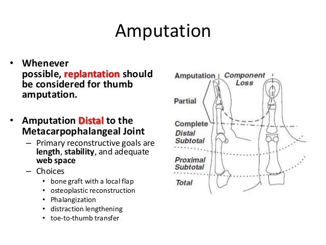 Amputation Toe Cpt Code