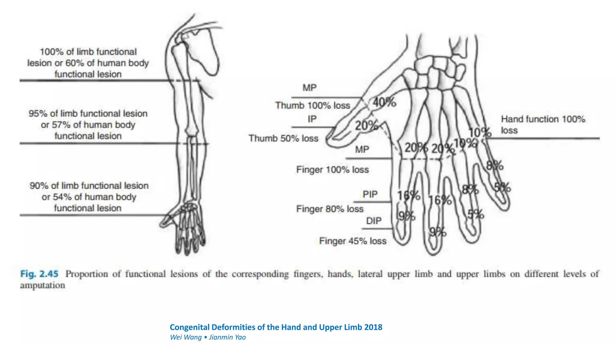Thumb soft tissue defects | PPTX