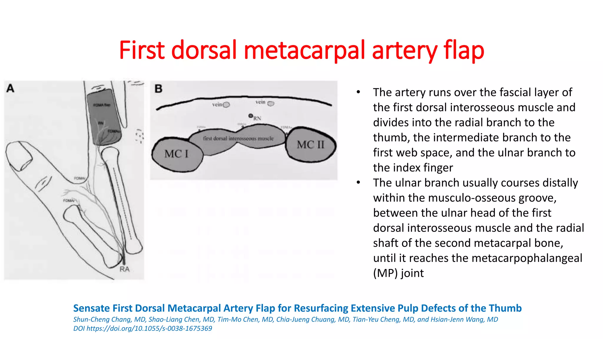 Thumb soft tissue defects | PPTX
