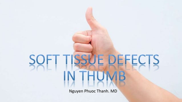 Thumb soft tissue defects | PPT