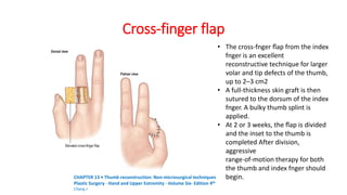 Thumb soft tissue defects | PPTX