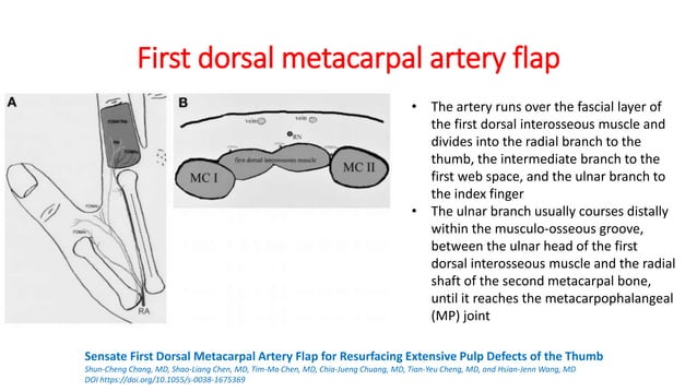 Thumb soft tissue defects | PPT