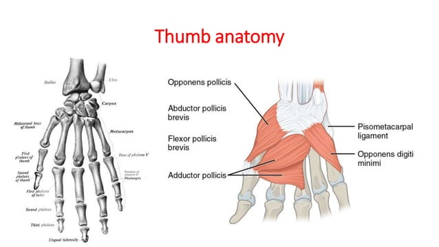 Thumb soft tissue defects | PPT