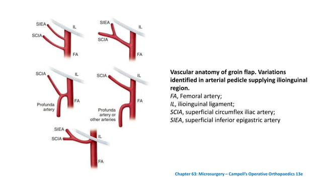 Thumb soft tissue defects | PPT
