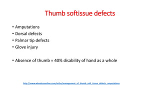 Thumb soft tissue defects | PPTX