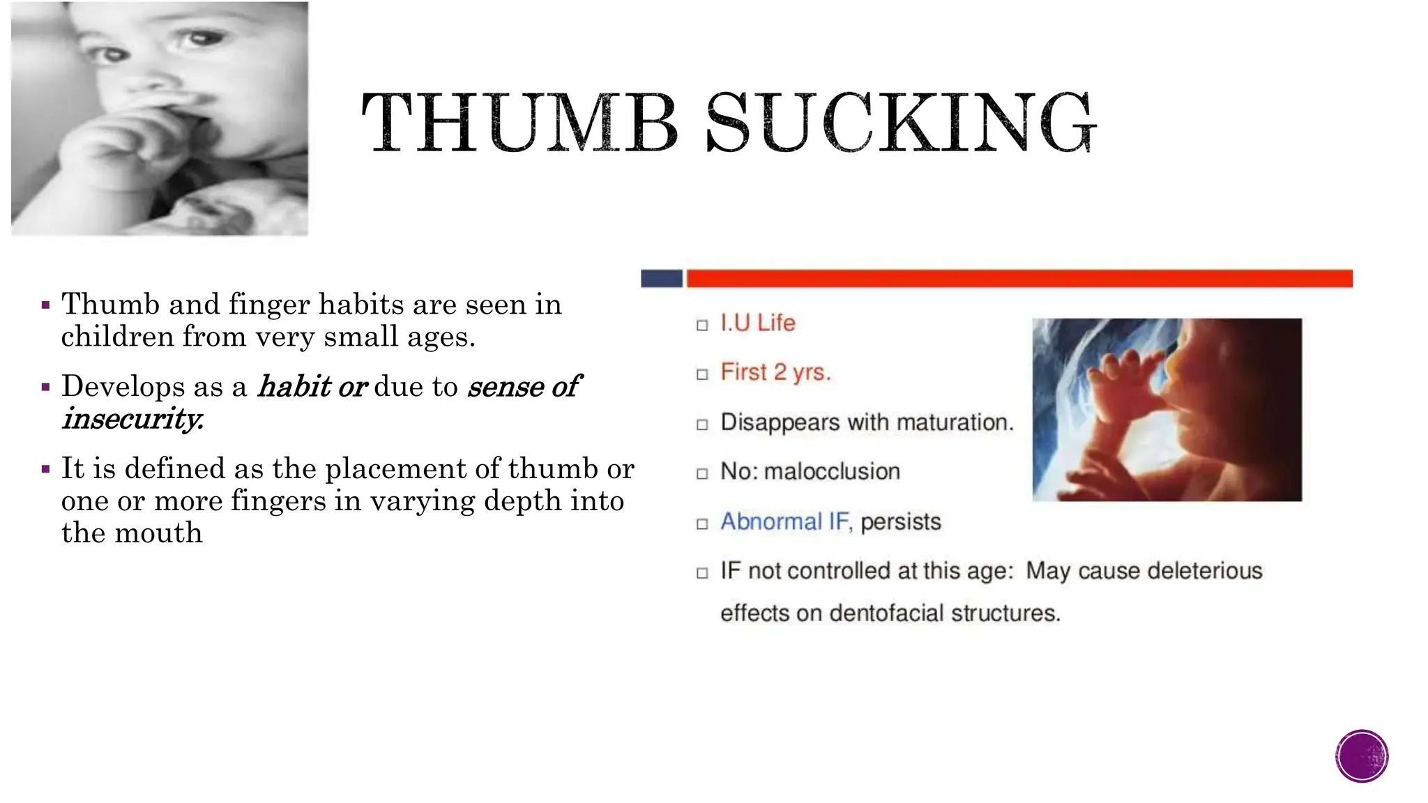 Introduction to oral habits and Thumb sucking and mouth breathing.pptx