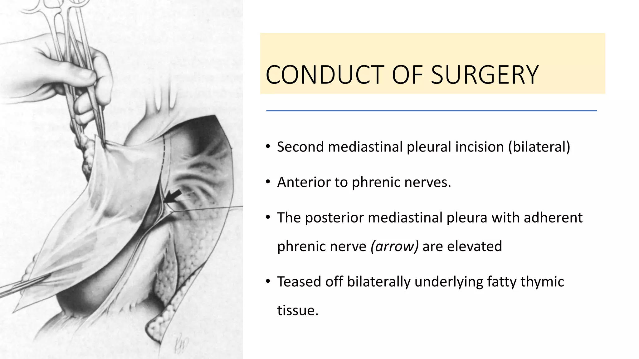 Thymectomy & Thymic Disorders - Clinical Implications, Multimodal and ...