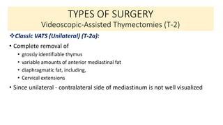 Thymectomy & Thymic Disorders - Clinical Implications, Multimodal and ...