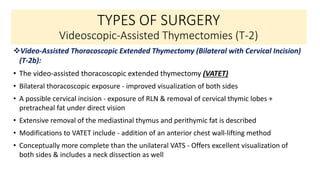 Thymectomy & Thymic Disorders - Clinical Implications, Multimodal and ...