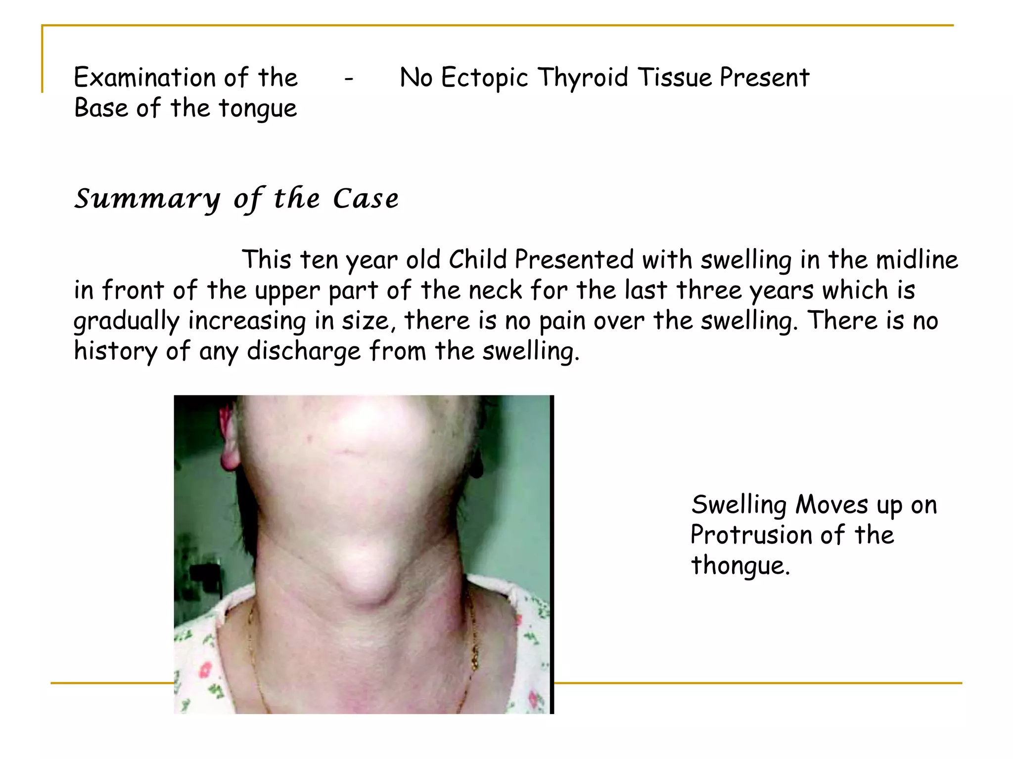 Thyroglossalcyst | PPT