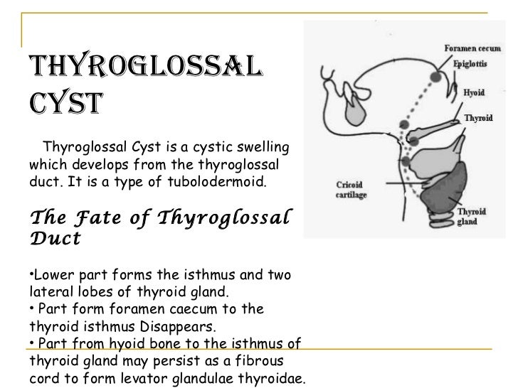 Thyroglossalcyst