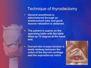 Thyroid surgery and neoplasms of thyroid | PPT