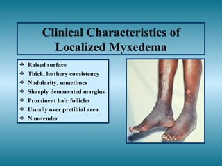 Hypothyroidism Signs and Symptoms Hypothyroidism Signs and Symptoms | PPT