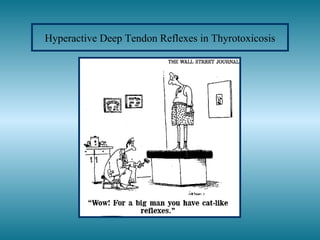 Hypothyroidism Signs and Symptoms Hypothyroidism Signs and Symptoms | PPT