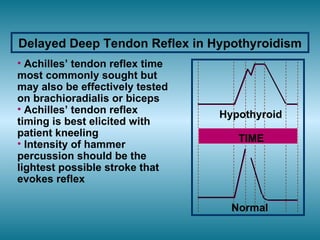 Hypothyroidism Signs and Symptoms Hypothyroidism Signs and Symptoms | PPT
