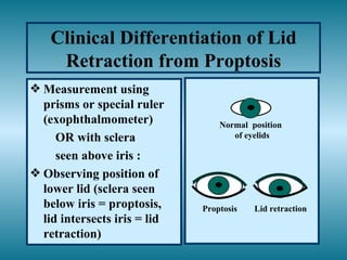 Hypothyroidism Signs and Symptoms Hypothyroidism Signs and Symptoms | PPT