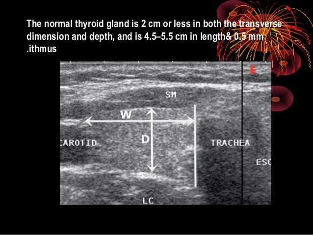 Thyroid ultrasound