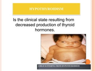 Thyroid | PPTX