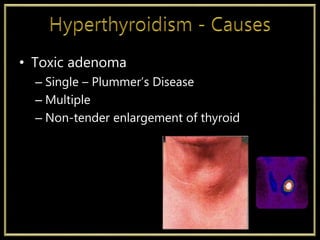 Review of Thyroid Dysfunction | PPTX