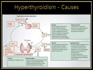 Review of Thyroid Dysfunction | PPTX | Thyroid Disorders | Endocrine ...