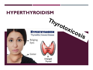 Thyroid and dental management | PPT