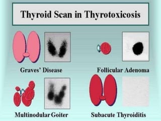 Nuclear Medicine - Thyroid - Procedure/Scan