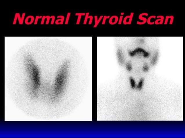 Nuclear Medicine - Thyroid - Procedure/Scan