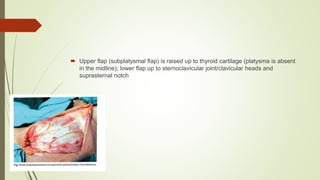 Thyroid | PPTX