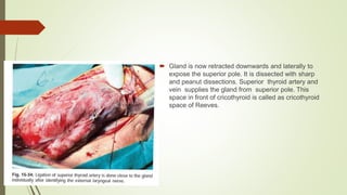 Thyroid | PPTX
