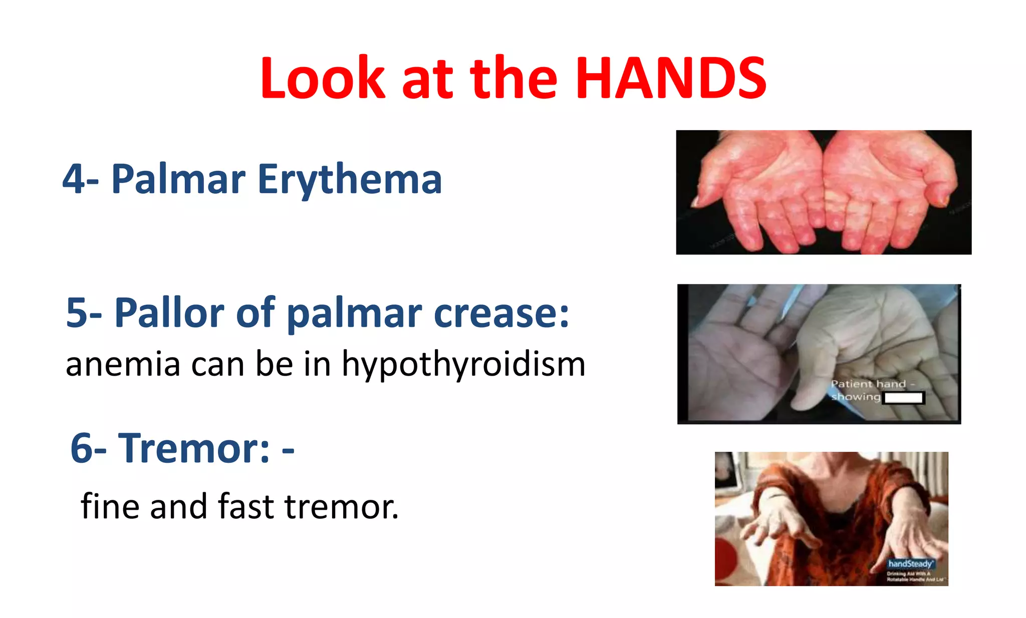 Thyroid History and Physical Examination | PPTX