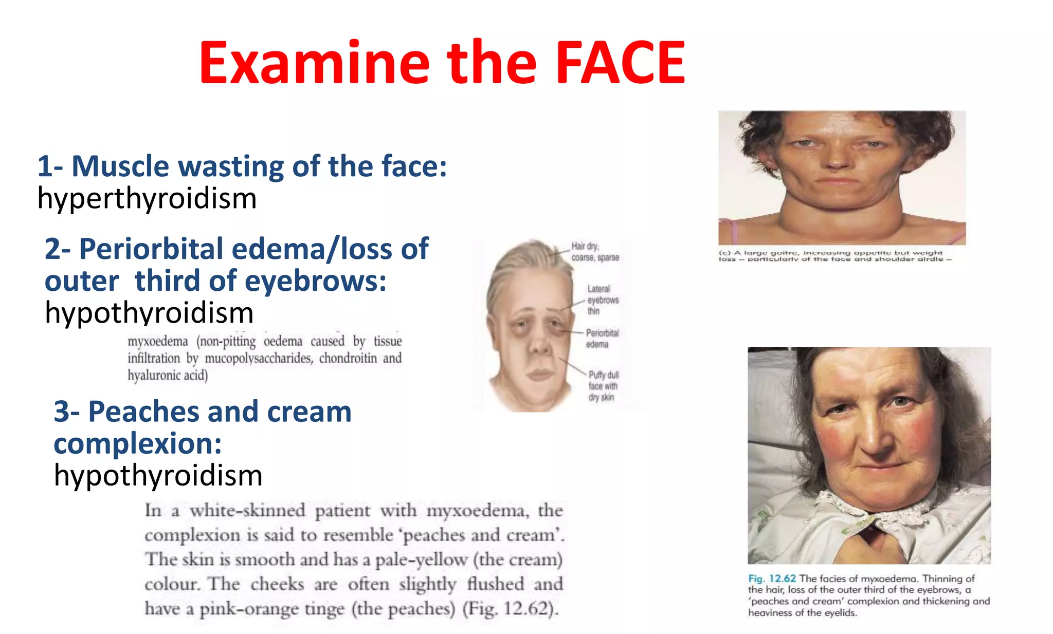 Thyroid History and Physical Examination | PPTX