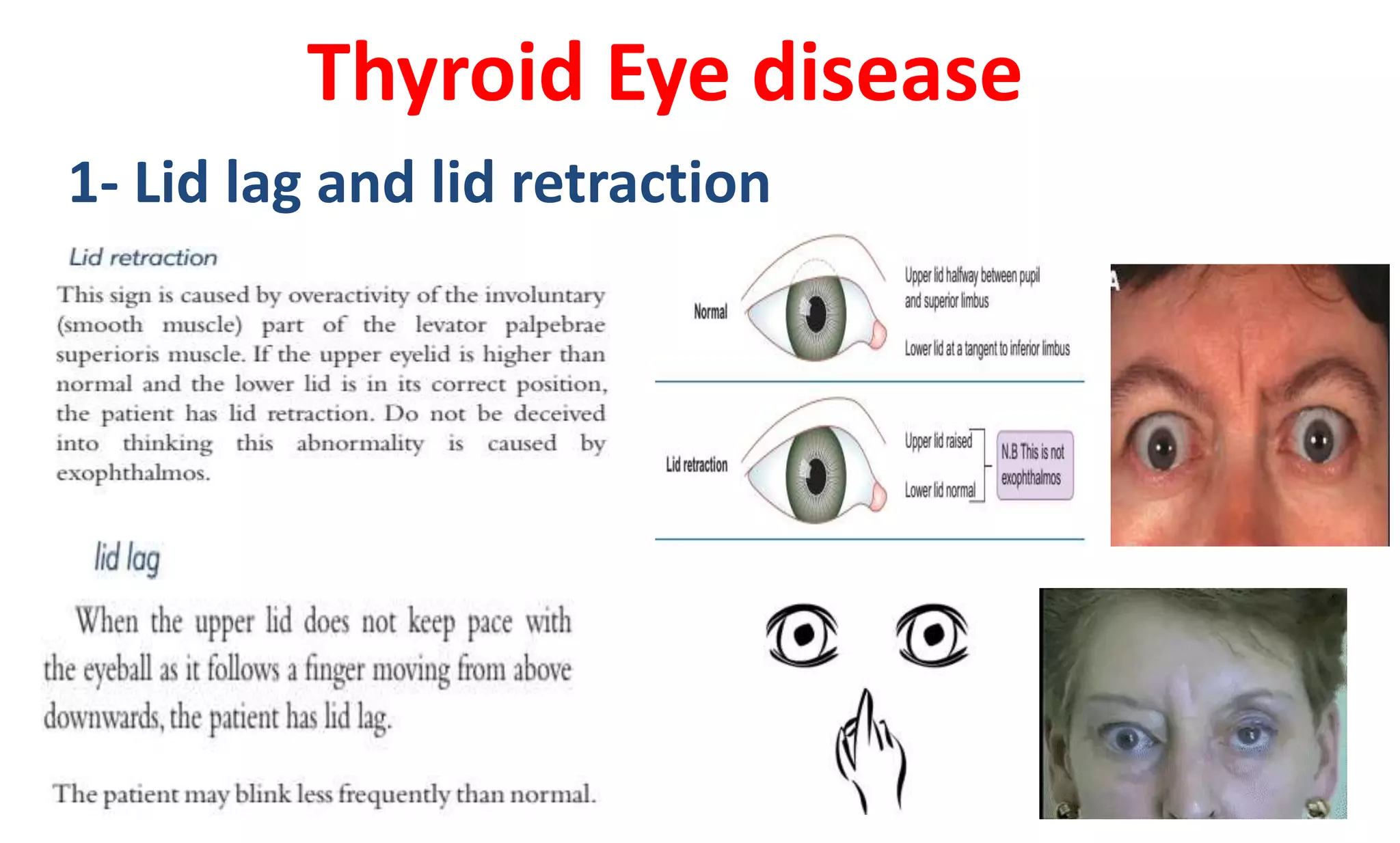 Thyroid History and Physical Examination | PPTX