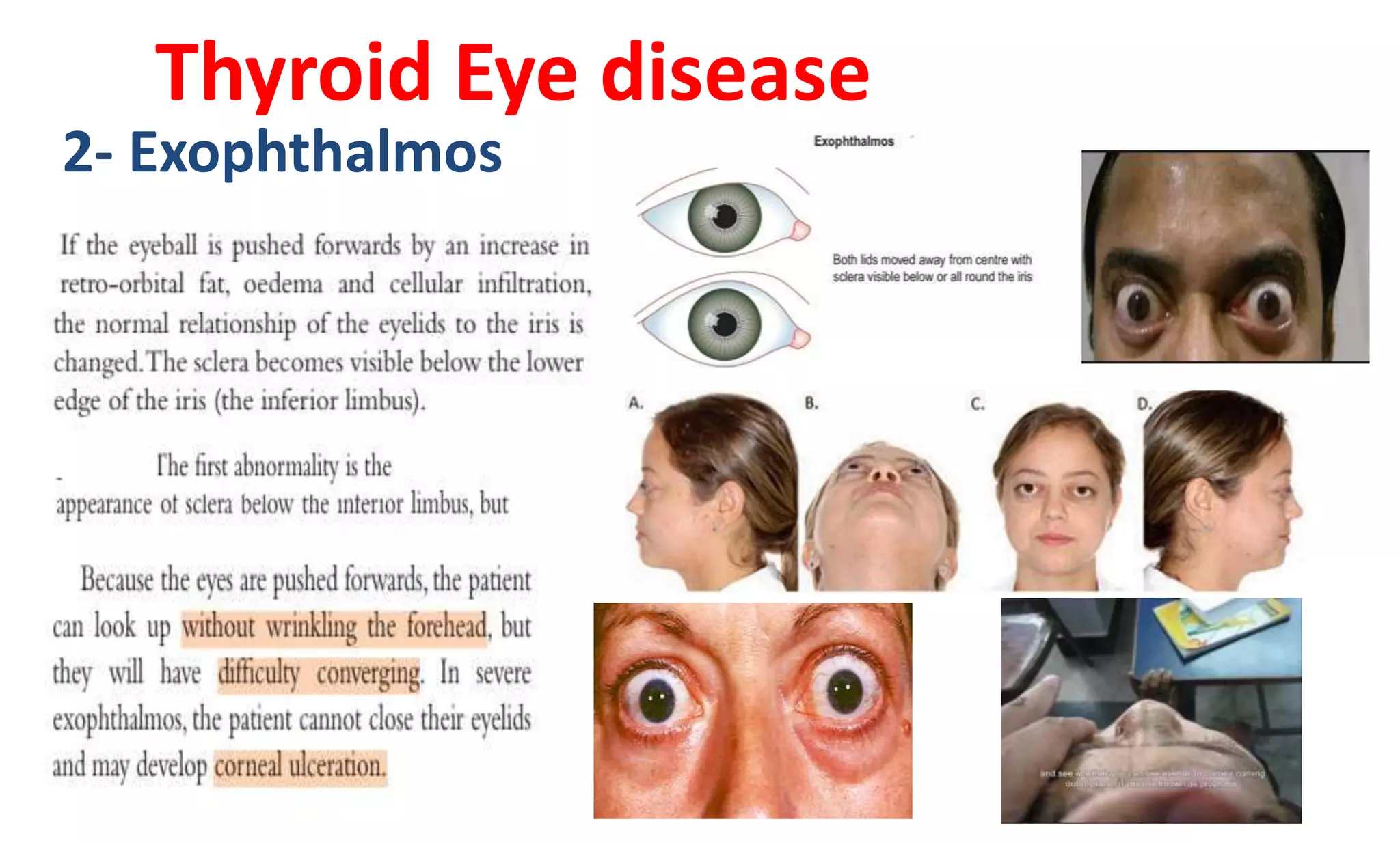 Thyroid History and Physical Examination | PPTX