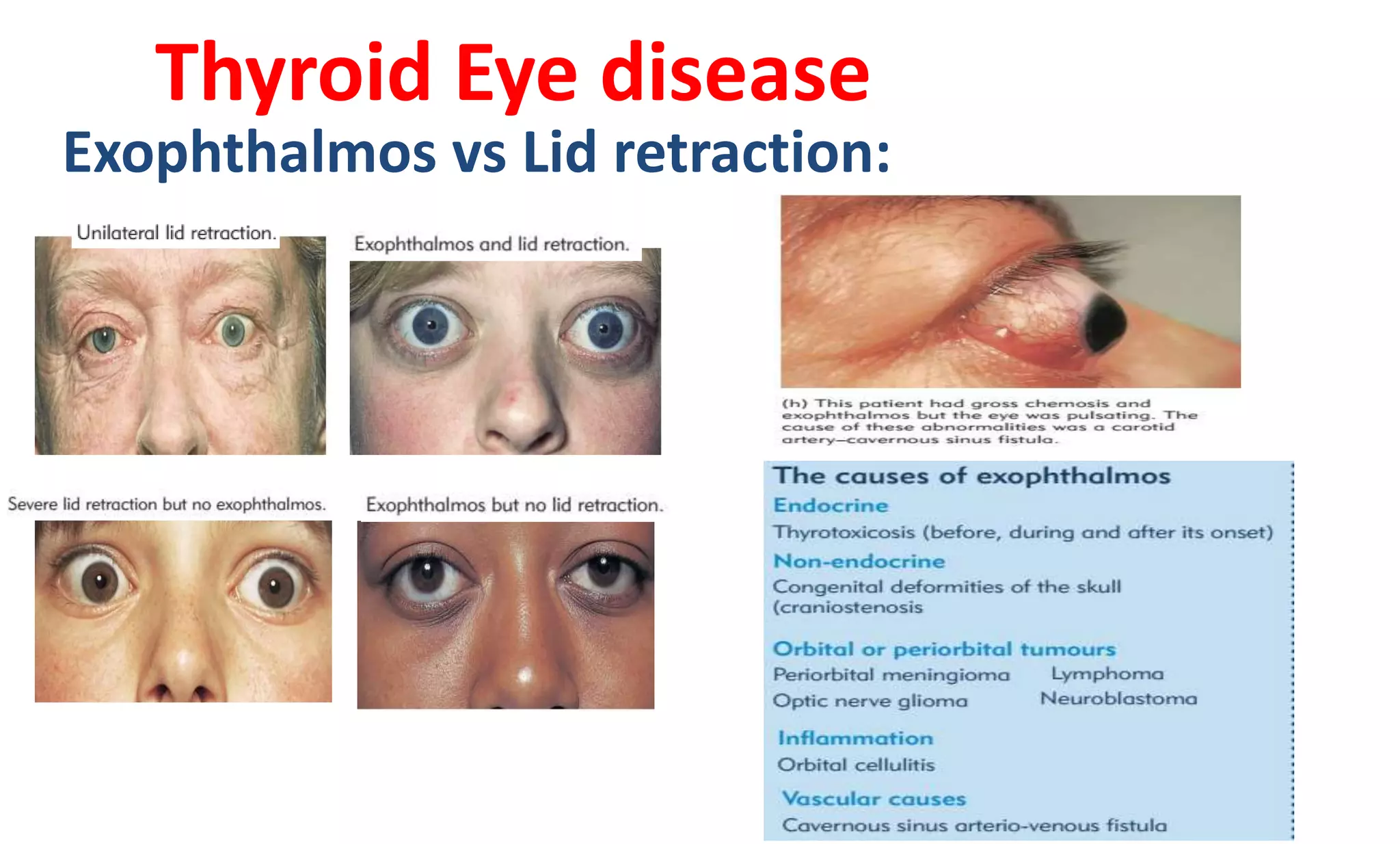 Thyroid History and Physical Examination | PPTX