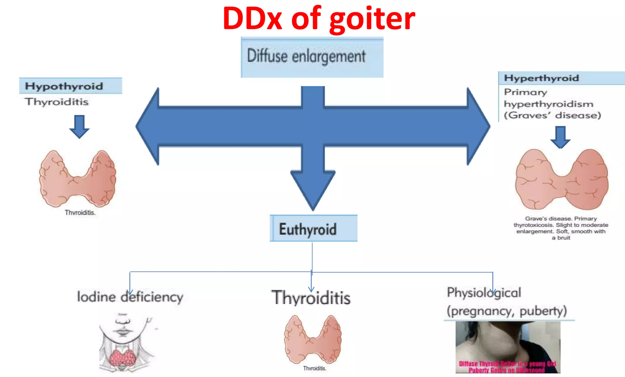 Thyroid History and Physical Examination | PPTX