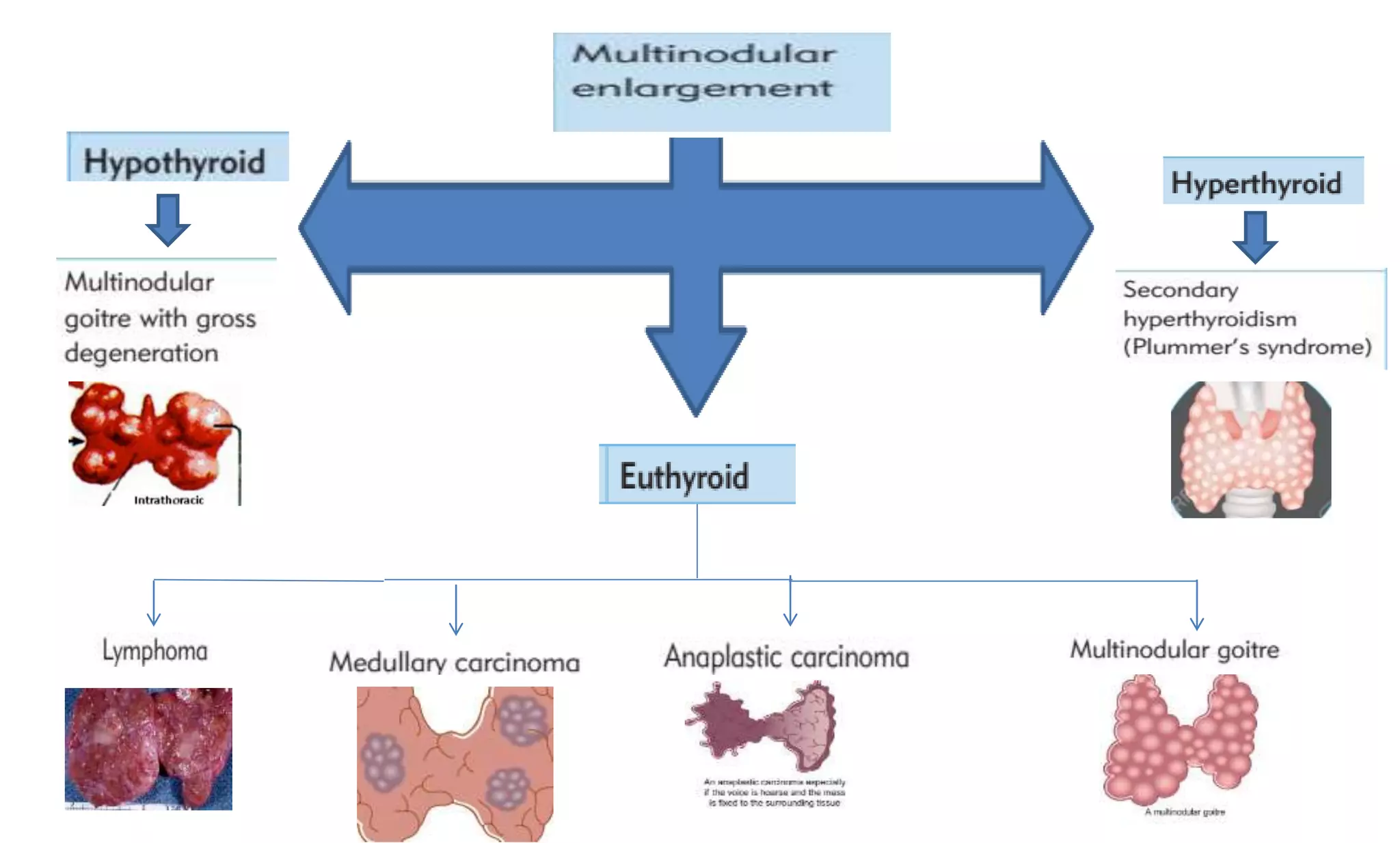 Thyroid History and Physical Examination | PPTX