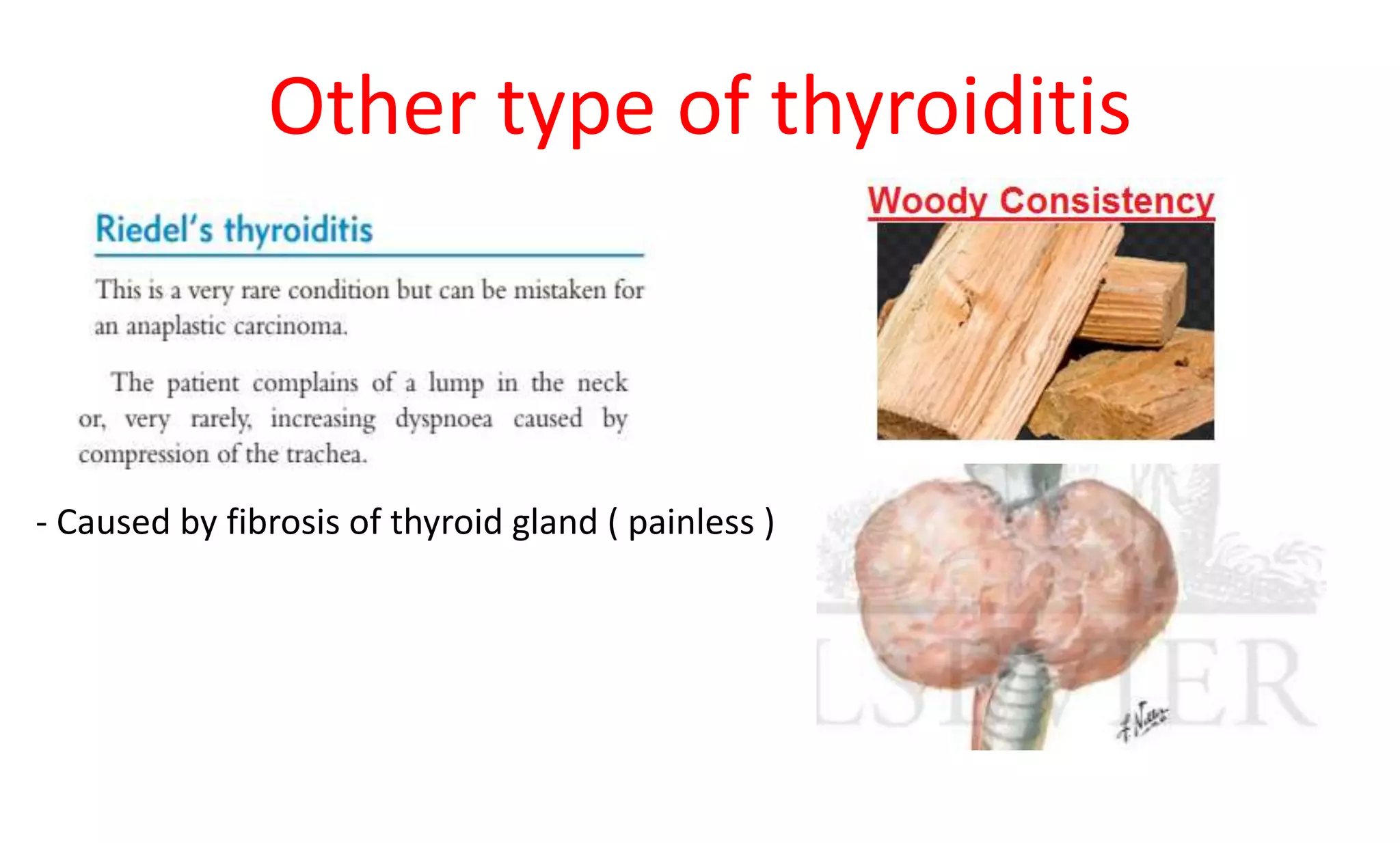 Thyroid History and Physical Examination | PPTX
