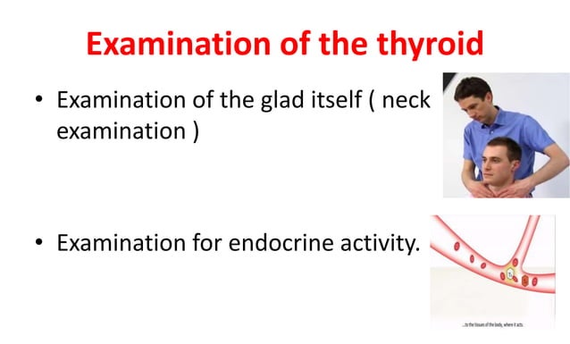 Thyroid History and Physical Examination | PPTX | Thyroid Disorders ...