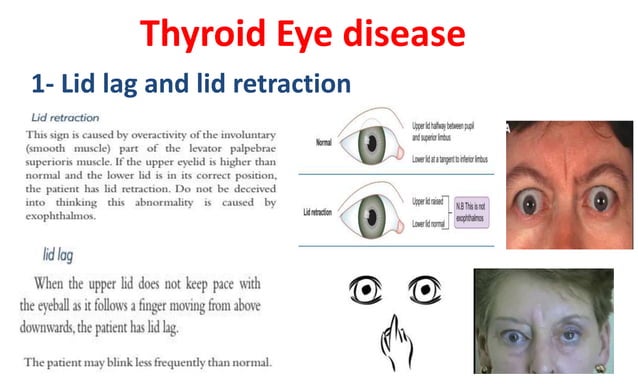 Thyroid History and Physical Examination | PPTX | Thyroid Disorders ...