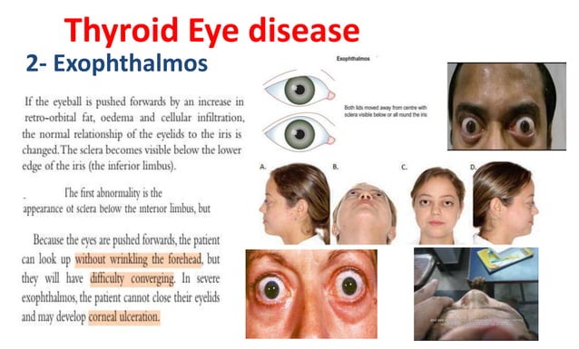 Thyroid History and Physical Examination | PPTX | Thyroid Disorders ...