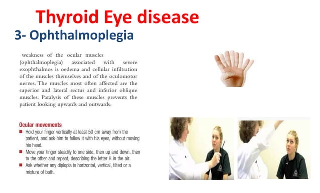 Thyroid History and Physical Examination | PPTX | Thyroid Disorders | Endocrine and Metabolic ...