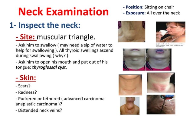 Thyroid History and Physical Examination | PPTX | Thyroid Disorders ...