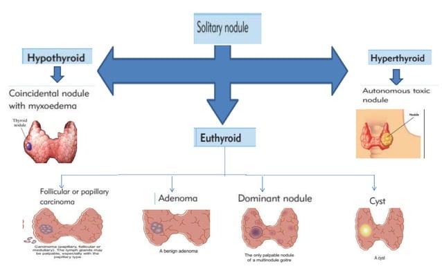 Thyroid History and Physical Examination | PPTX | Thyroid Disorders ...