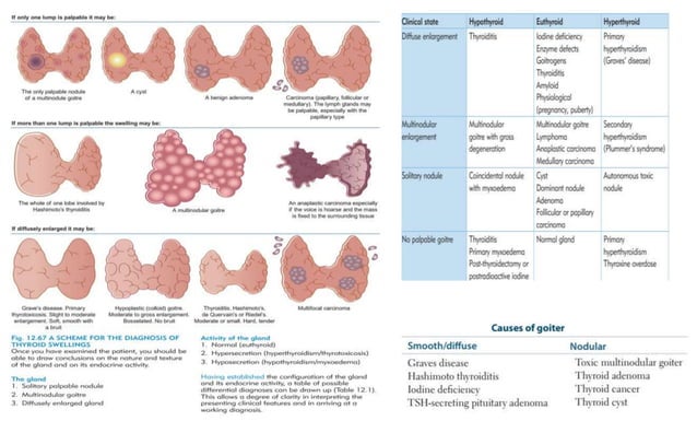 Thyroid History and Physical Examination | PPTX | Thyroid Disorders ...