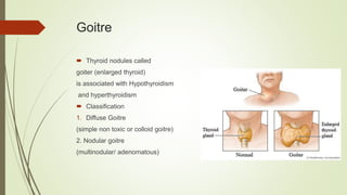 Thyroid | PPT
